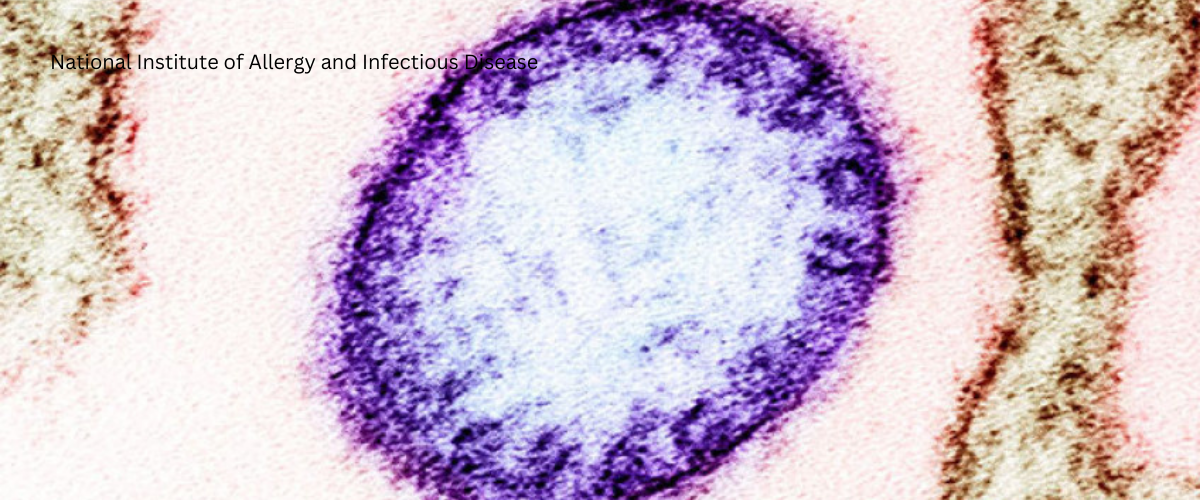 Nipah virus outbreak in India: what Filipinos need to know - Generation